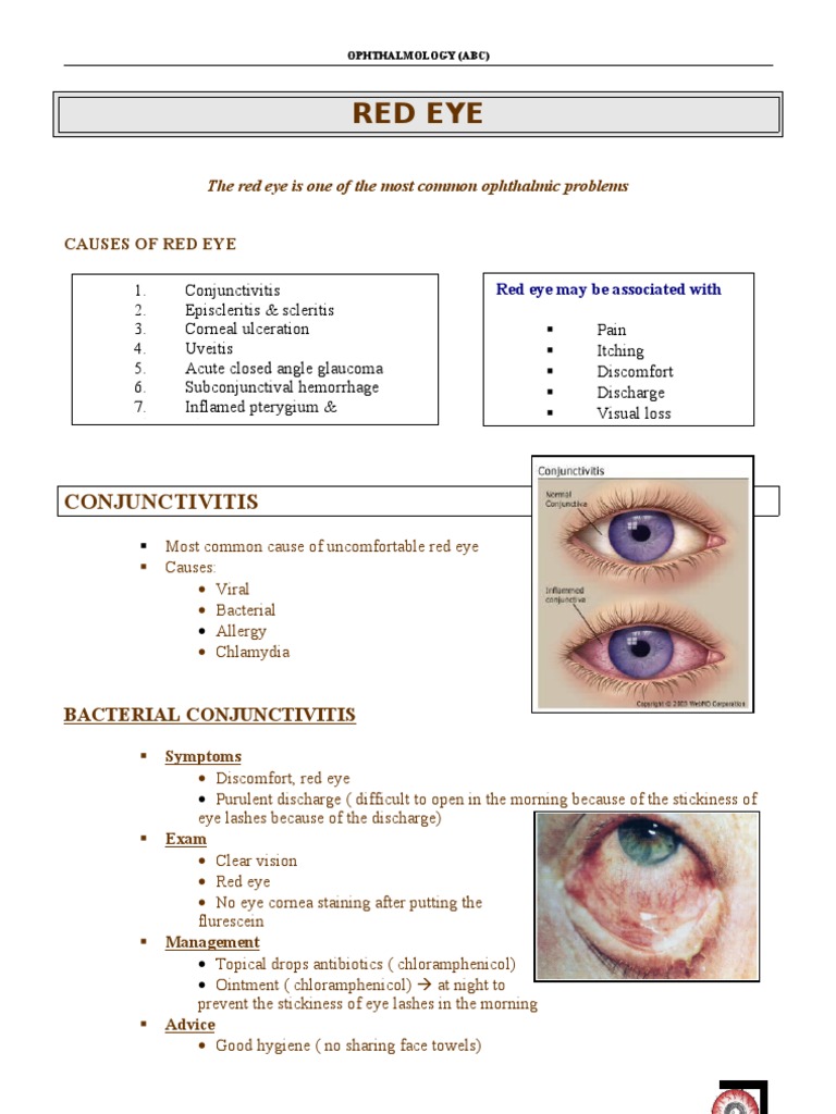 Red Eye | Download Free PDF | Eye | Epidemiology