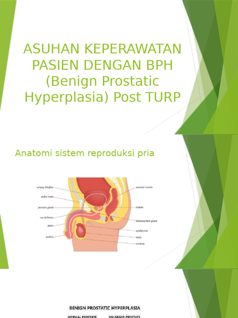 Asuhan Keperawatan Pasien Dengan BPH Turp | PDF