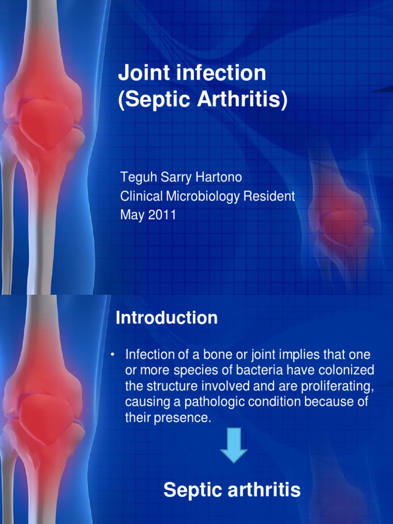 Joint Infection (Septic Arthritis) : Teguh Sarry Hartono Clinical ...