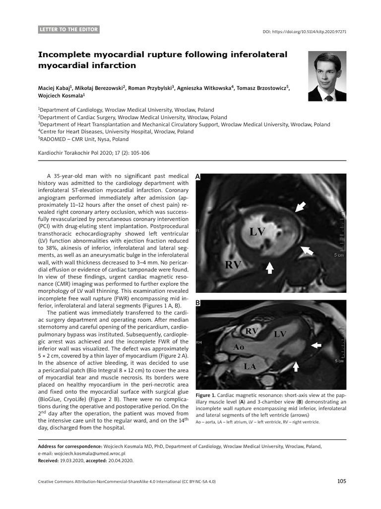 Cardio 4 | PDF