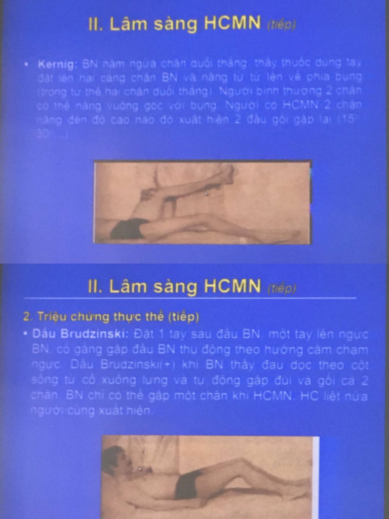 LEC 21 B Sung PDF | PDF