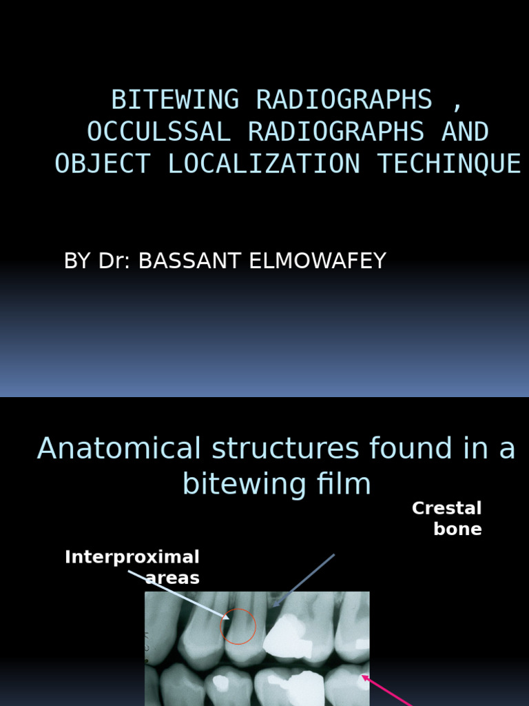 Bitewing and Occulssal Radiographs Final | PDF