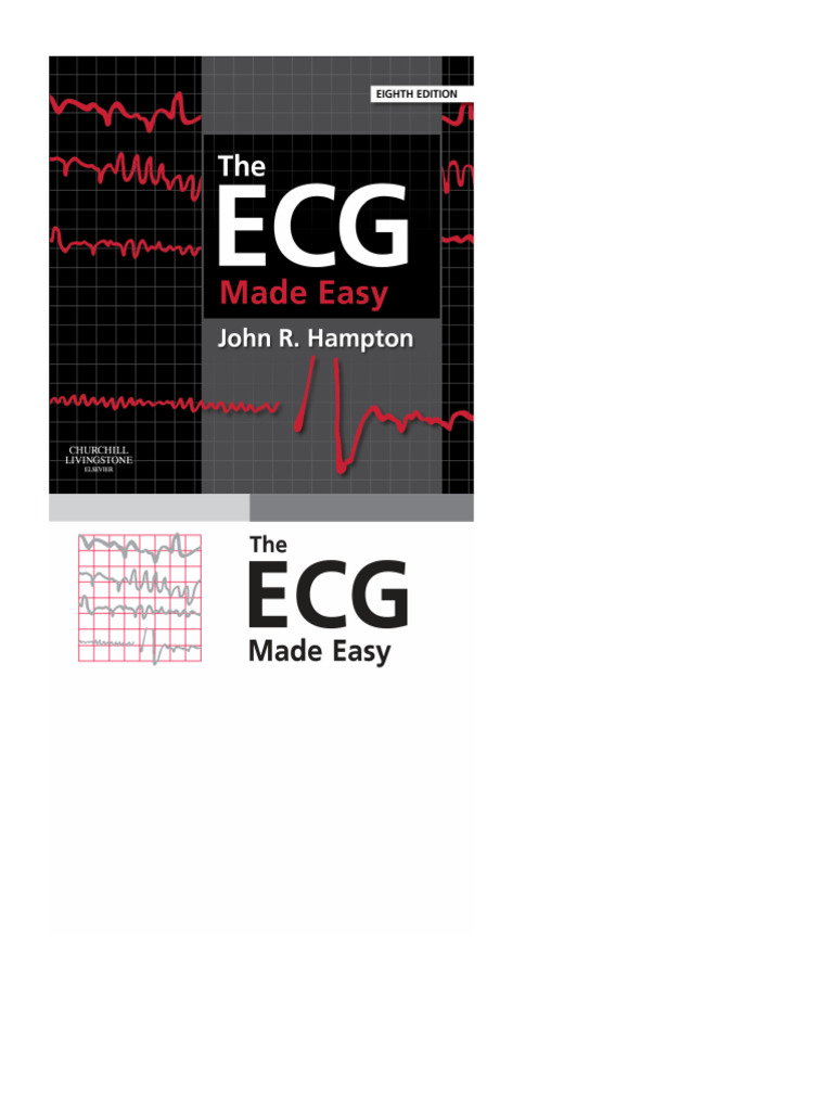 The ECG Made Easy 8th Ed - PDF - DocDroid | PDF