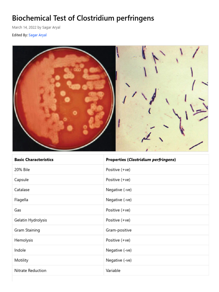 Biochemical Test of Clostridium Perfringens | PDF