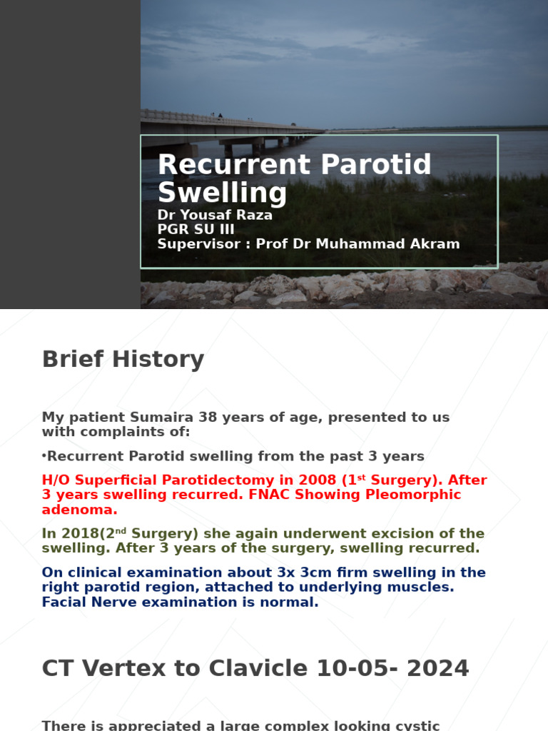 Recurrent Parotid Swelling | PDF