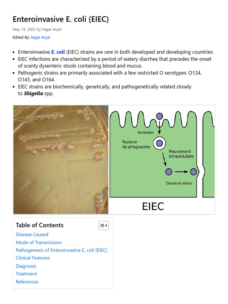 Enteroinvasive E. Coli (EIEC) | PDF