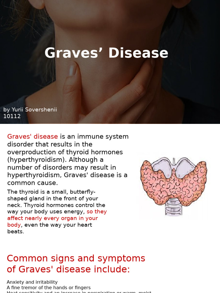 graves disease | PDF