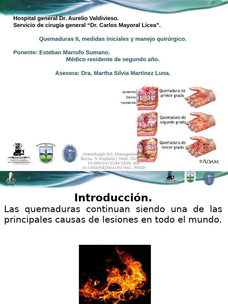 Quemaduras II | PDF
