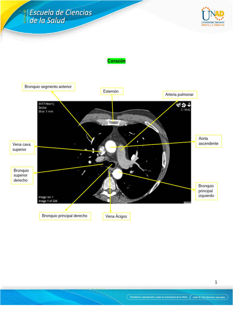 Anexo Tarea 4 - Correlacionar - CORAZON | PDF