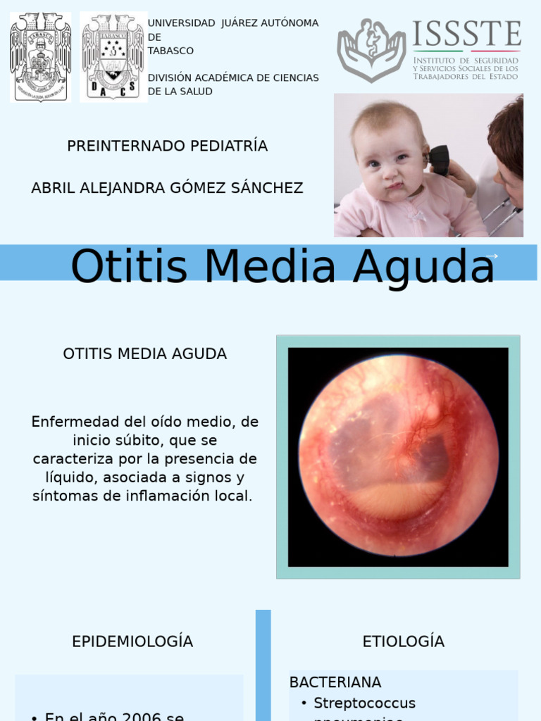 Otitis Media Aguda | PDF