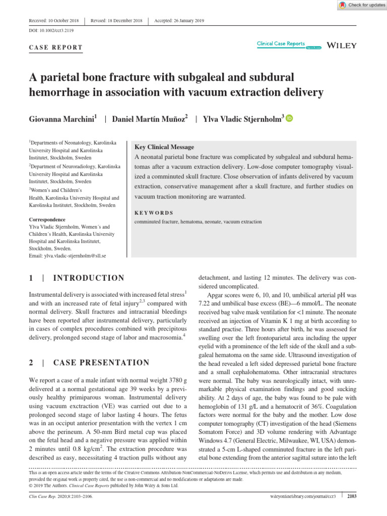 Clinical Case Reports - 2019 - Marchini - A Parietal Bone Fracture With ...