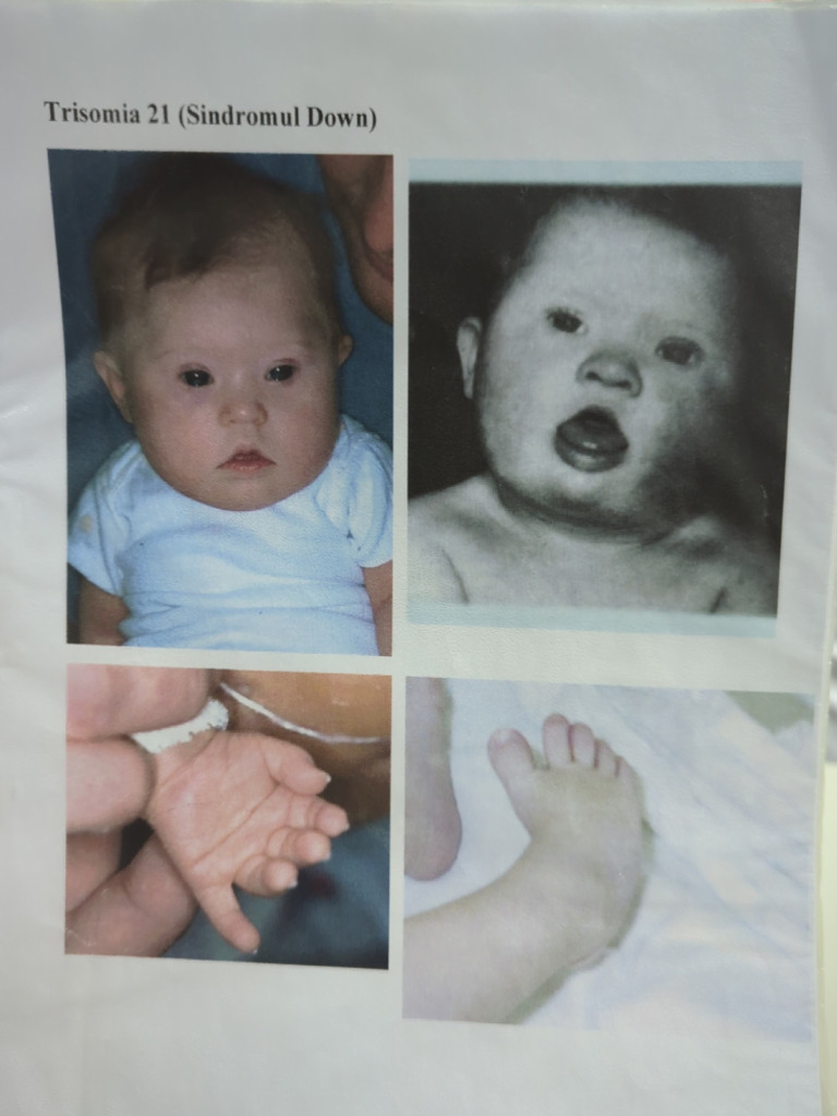 genetics-syndromes-pdf