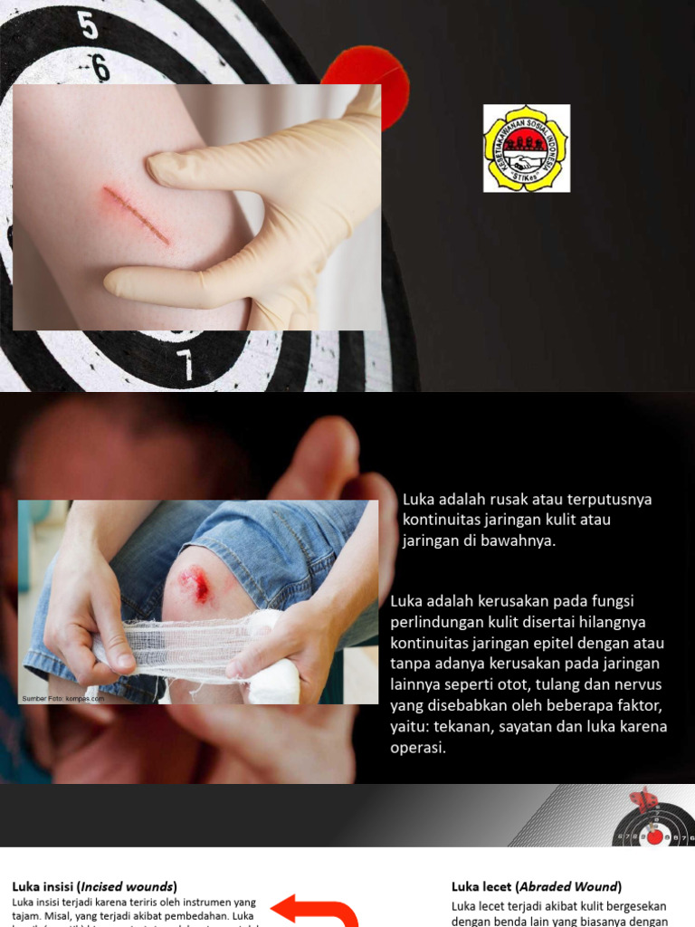 FROM ALIF. Pertemuan 2 Konsep Luka | PDF
