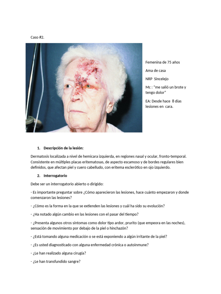 Caso 2 | PDF