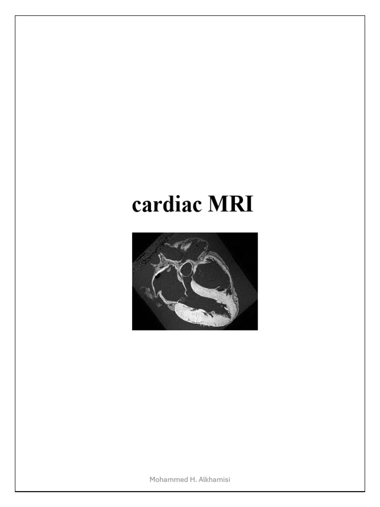 Cardiac MRI | PDF