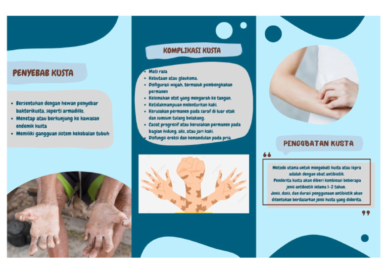 Leaflet Kusta 2 | PDF