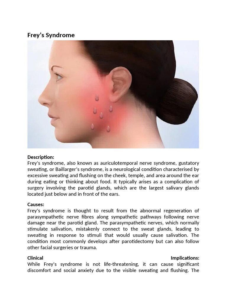Frey's Syndrome | PDF