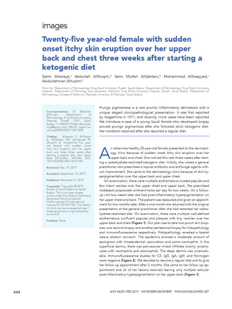 Alkeraye Et Al 2019 Twenty Five Year Old Female With Sudden Onset Itchy ...