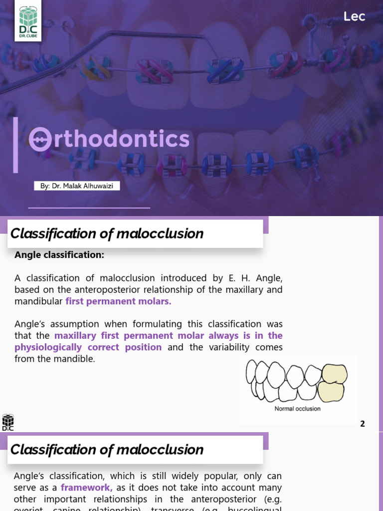 Ortho4 Lec.3 Classification of Malocclussion | PDF