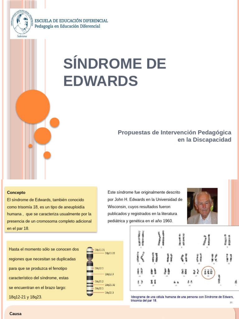 Síndrome de Edwards | PDF | Especialidades Medicas | Enfermedades y ...
