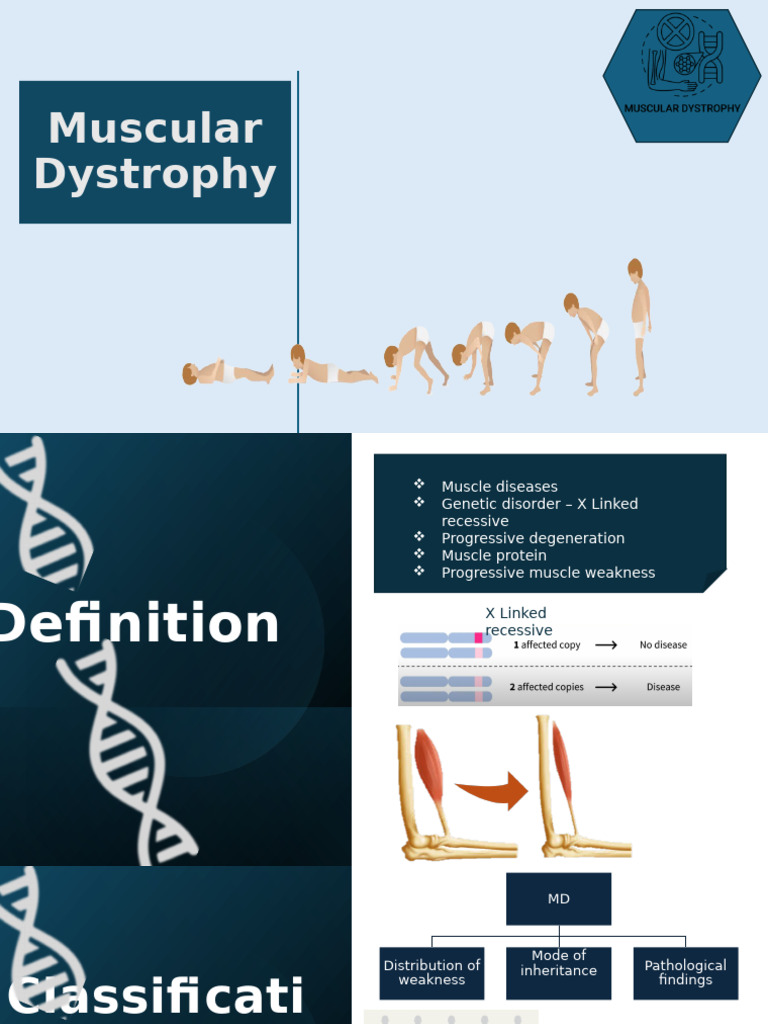 Muscular Dystrophy Final | PDF