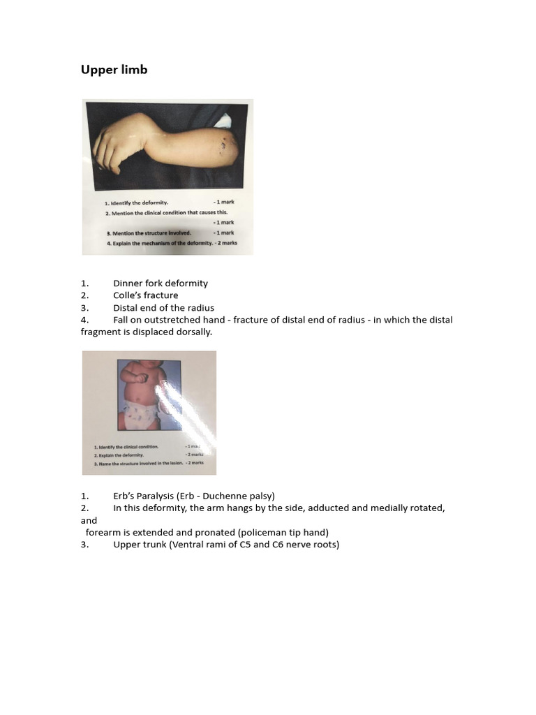 1.upper Limb - OSPE | PDF