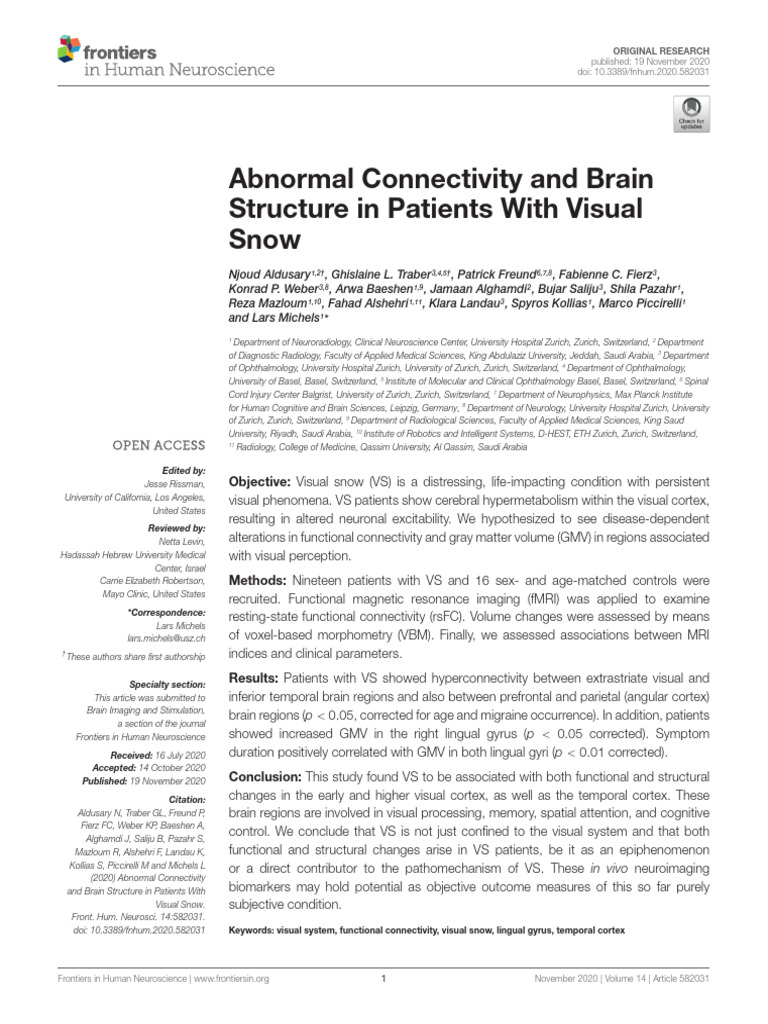 Aldusary Et Al. - 2020 - Abnormal Connectivity and Brain Structure in ...