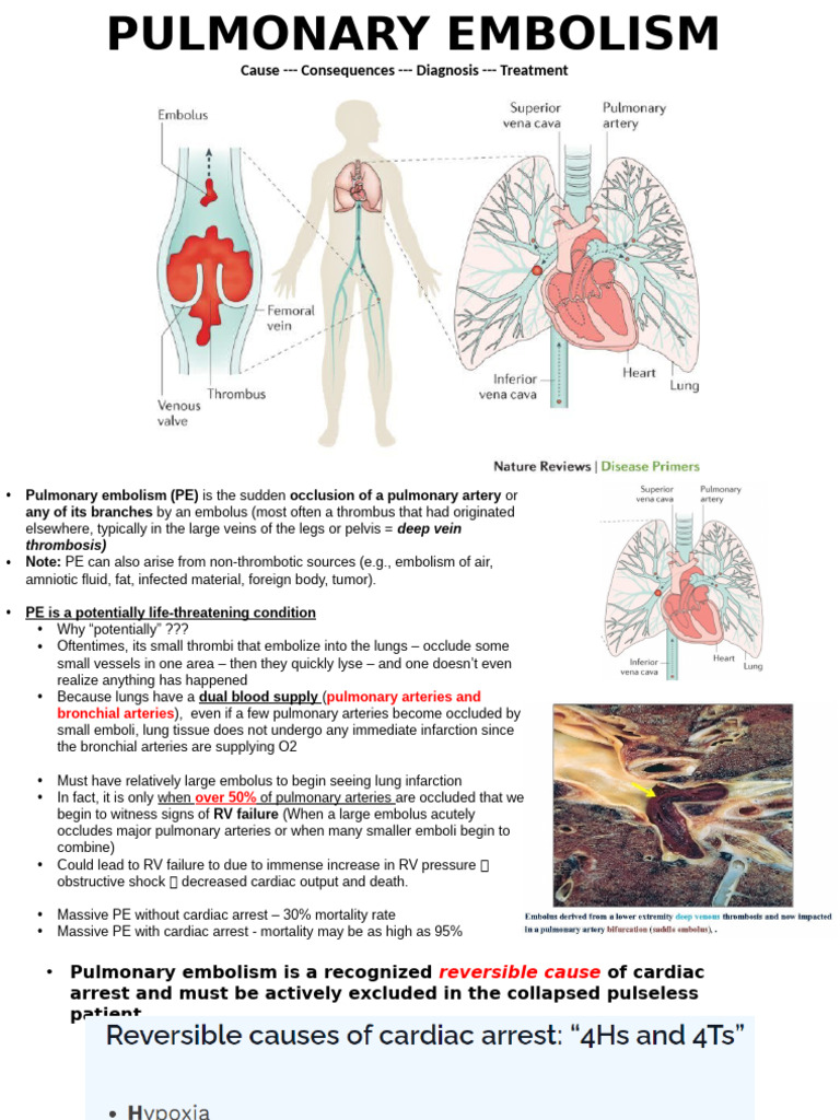 PULMONARY EMBOLISM PowerPoint | PDF