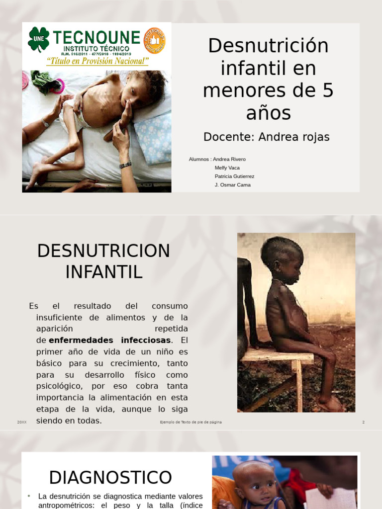 Desnutrición Infantil En Menores De 5 Años Nueva Pdf