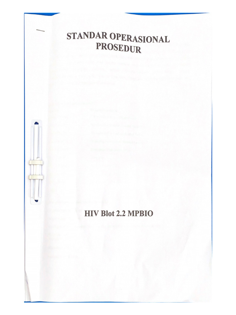 HIV Western Blot | PDF