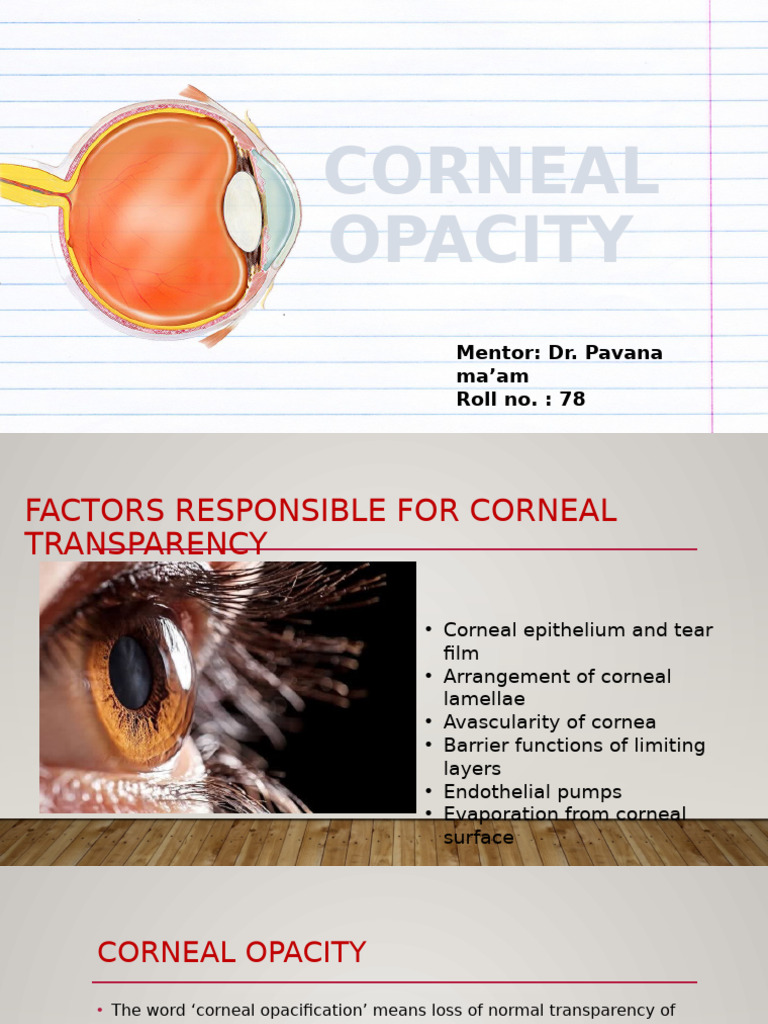 Ophthal Corneal Opacity | PDF