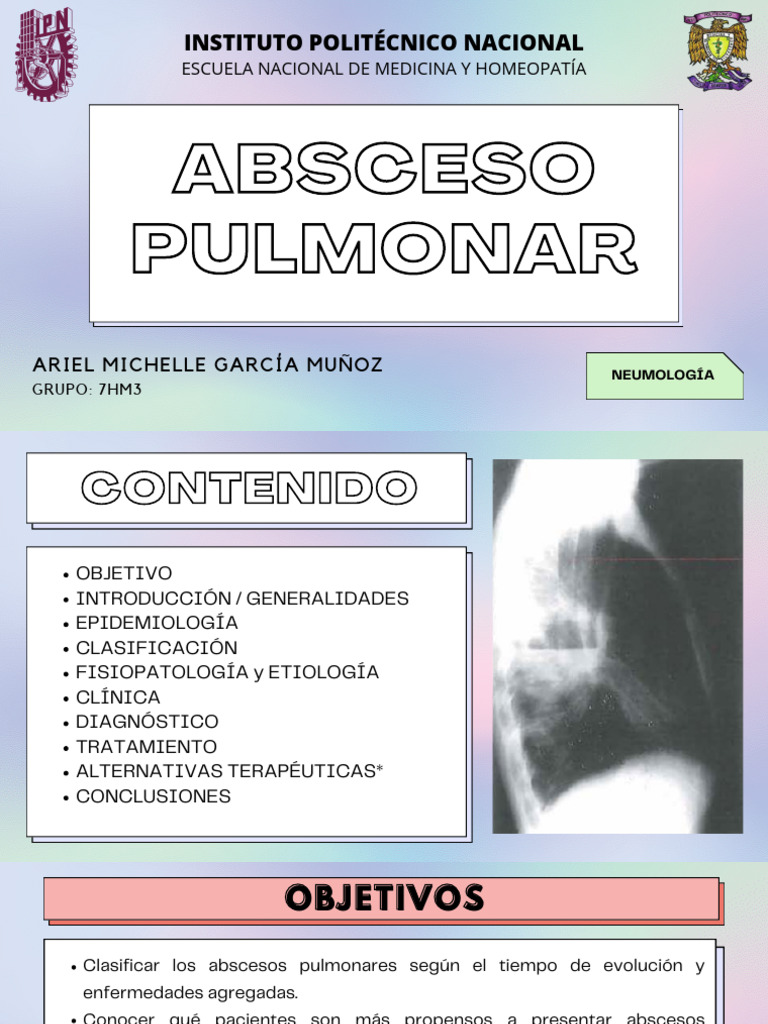 1604 - Absceso Pulmonar | PDF
