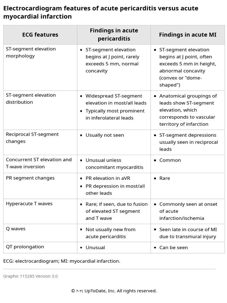 Electrocardiogram Features of Acute Pericarditis Versus Acute ...
