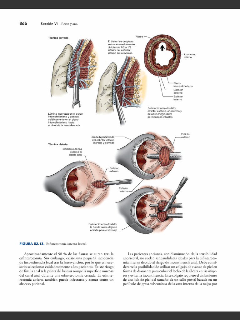 Operaciones Abdominales de Maingot 13a Edicion - Biblioteca 2 | PDF