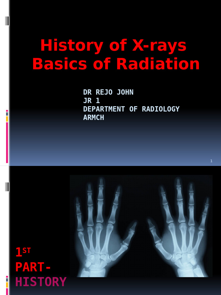 History - of - X - Ray RJ | PDF