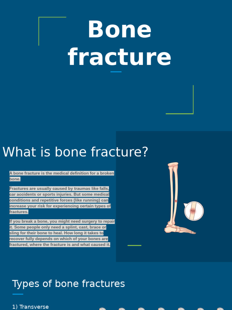 Bone Fracture | PDF