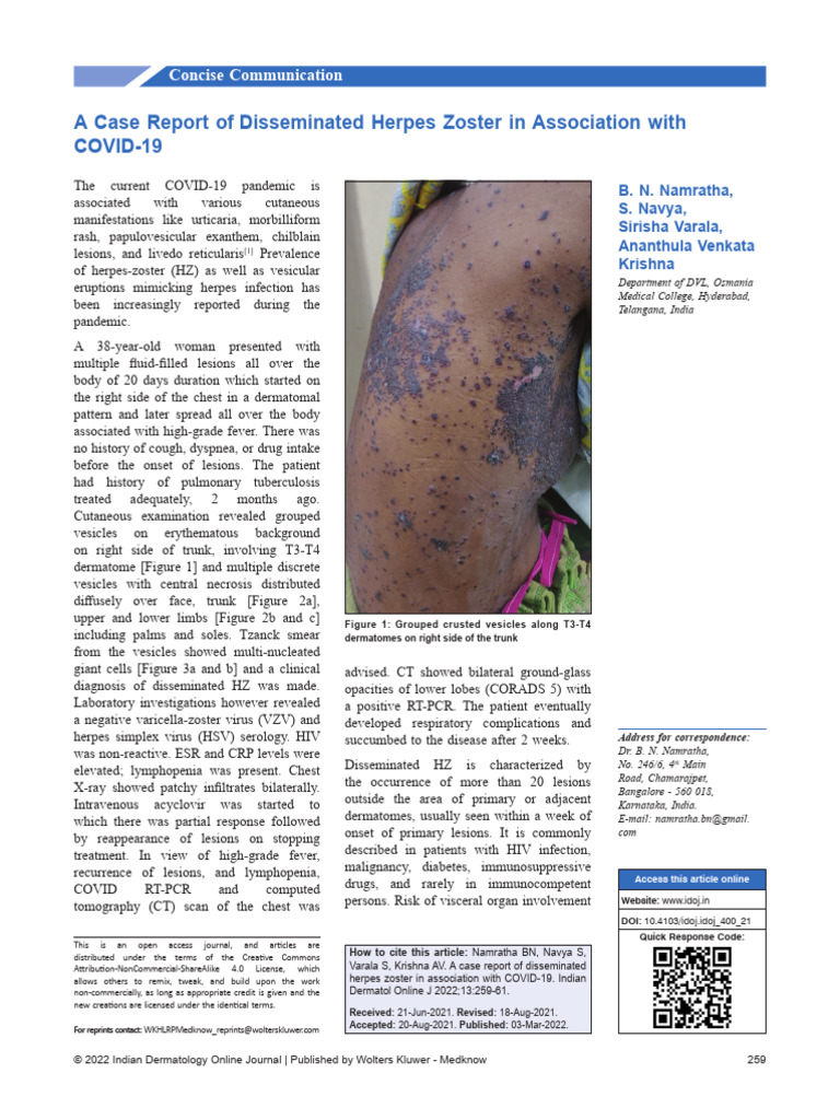 Herpes Zoster Diseminata 5 | PDF