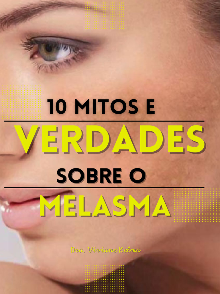 Dravivianekelma Explica Mitos e Verdade Sobre Melasma PDF | PDF
