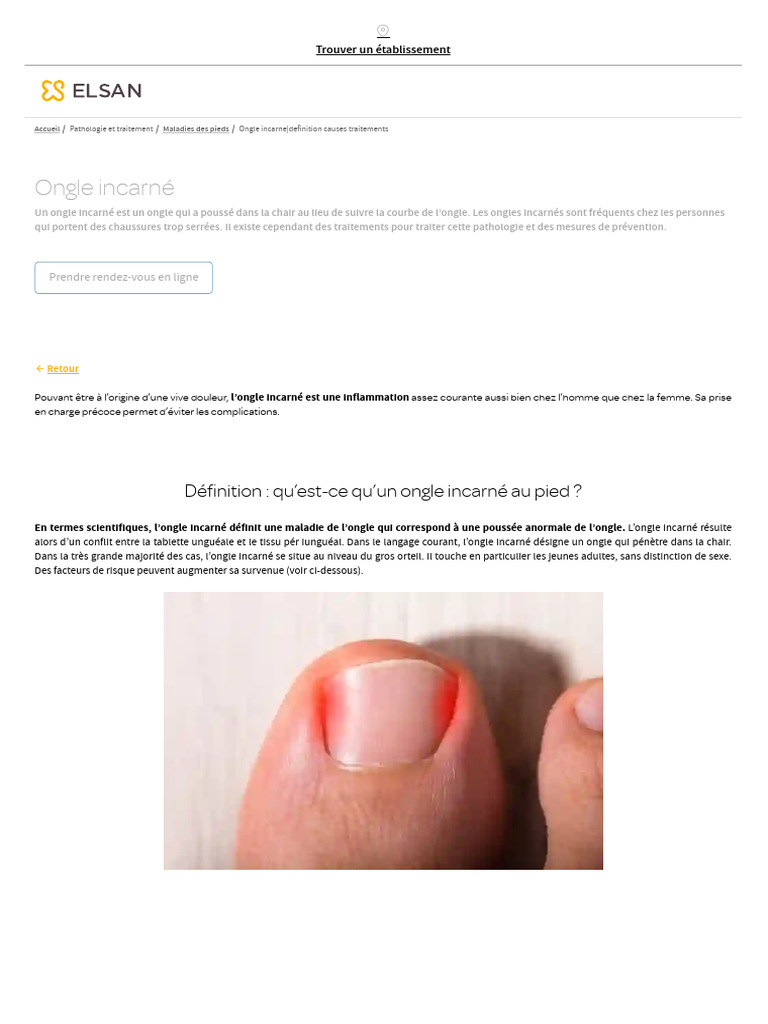 Ongle Incarné - Définition, Causes Et Traitements - ElsanOngle I | PDF