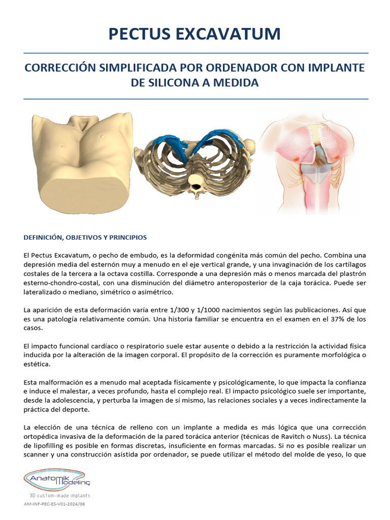 ES - Ficha de Informacion - Pectus Excavatum | PDF | Especialidades ...