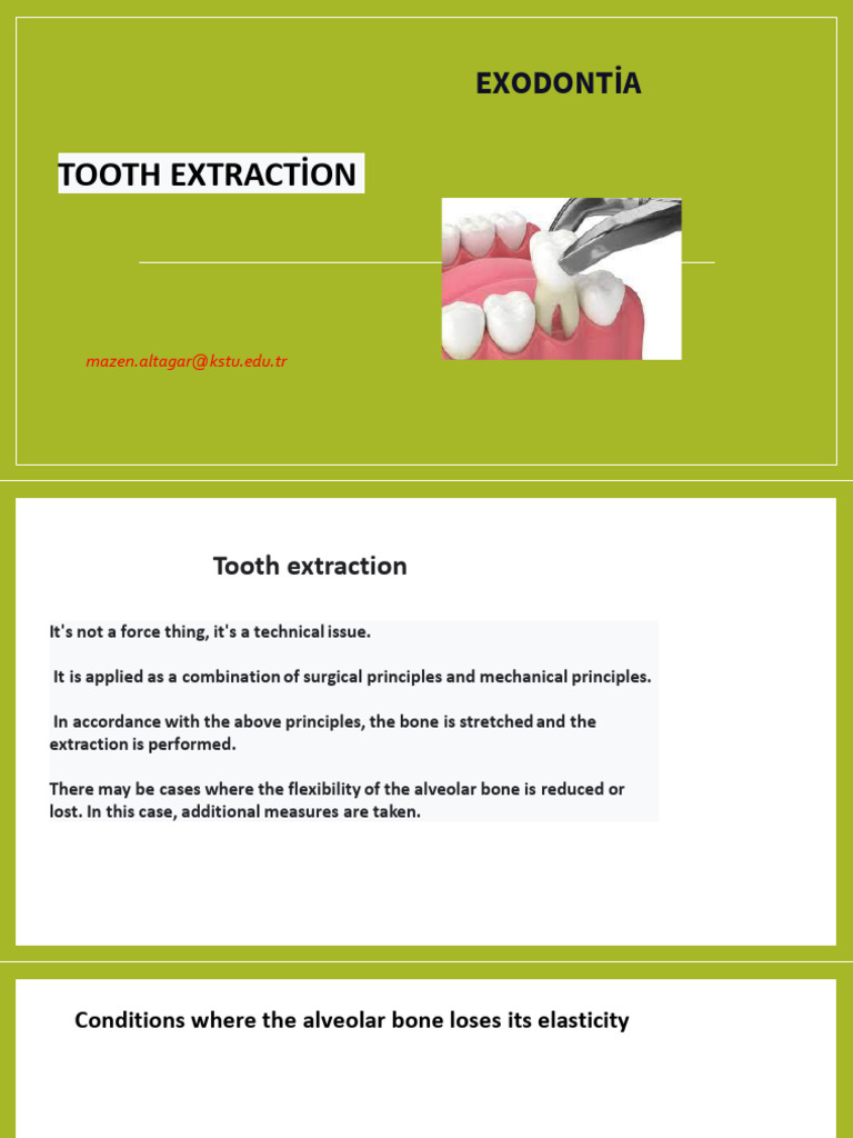 Tooth Extraction PDF | PDF