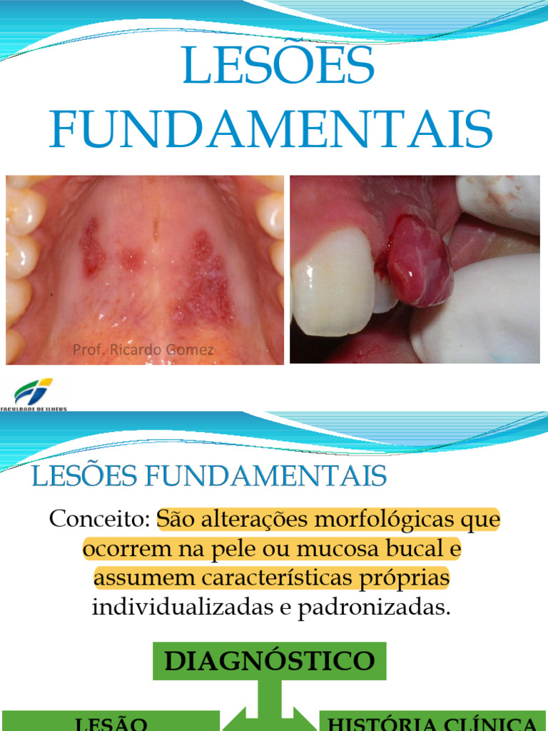 4 Parte - Lesoes Fundamentais | PDF