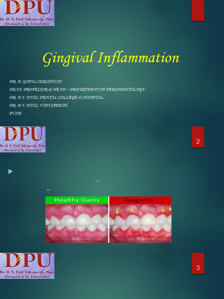 Gingival Inflammation | PDF