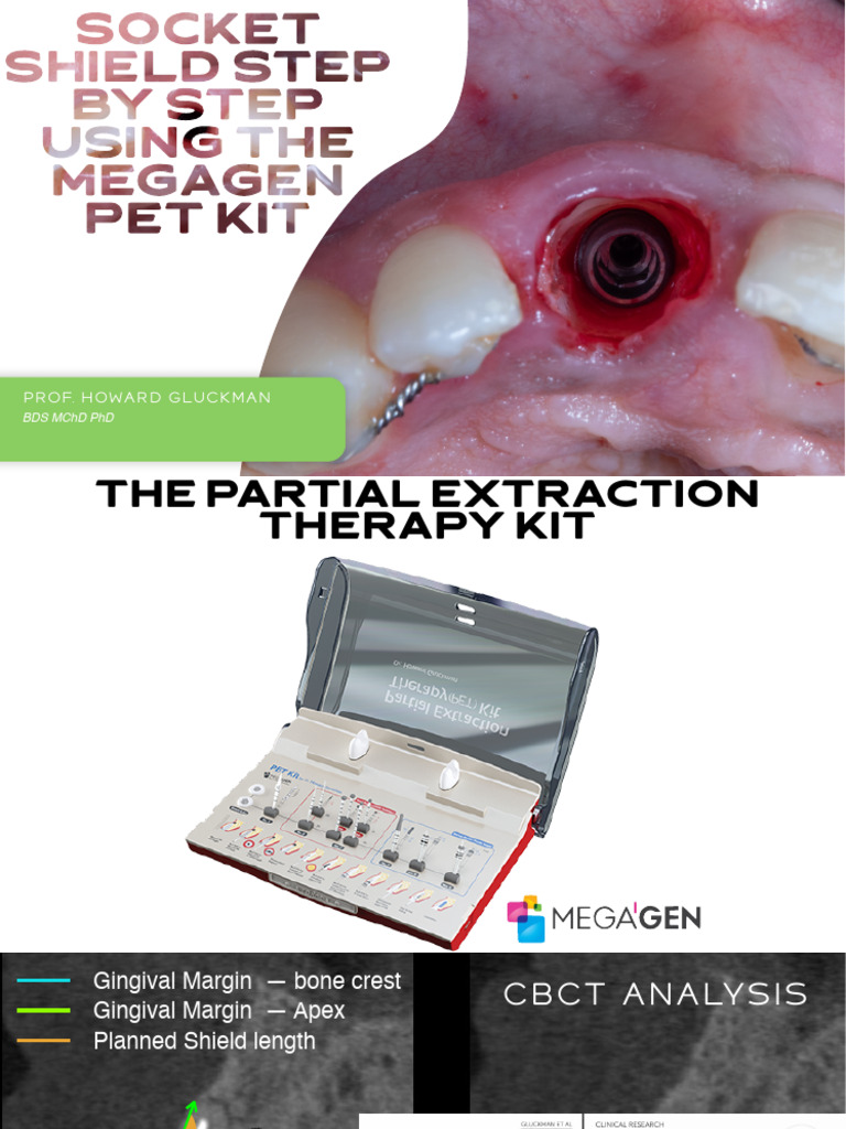 SS Step by Step PET Kit v2 Compressed | PDF