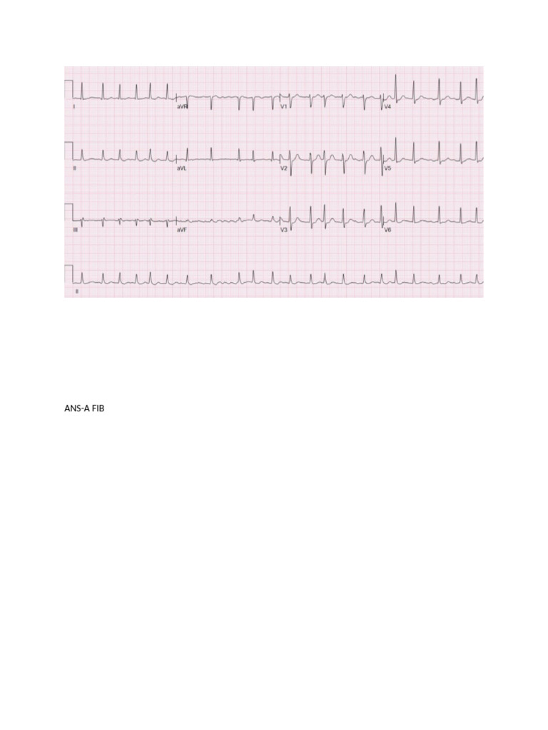 Ecg Practice | PDF