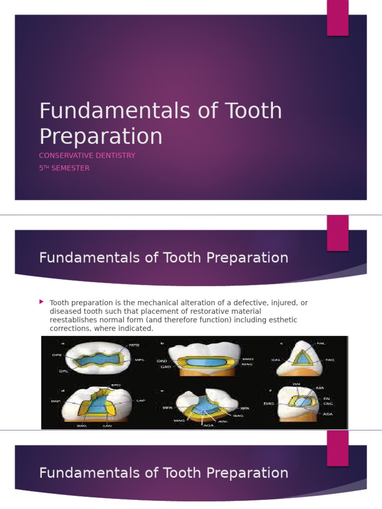 Fundamental of Tooth Preparation 1st-1 | PDF