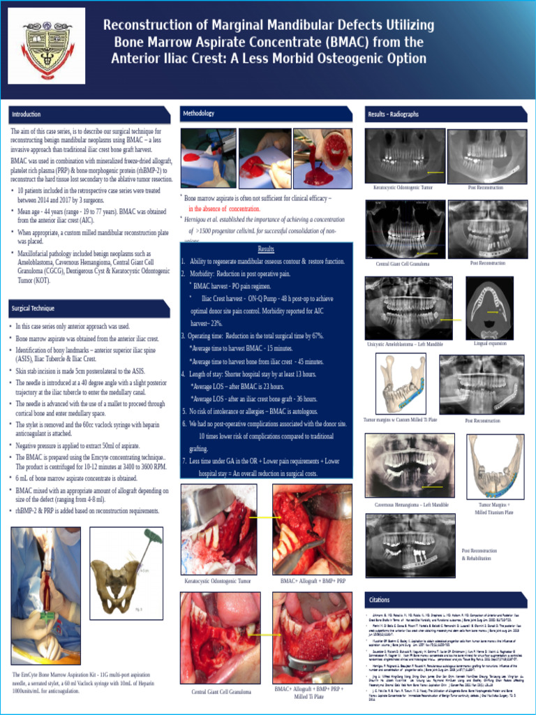 Reconstruction of Marginal Mandibular Defects Utilizing Bone Marr | PDF