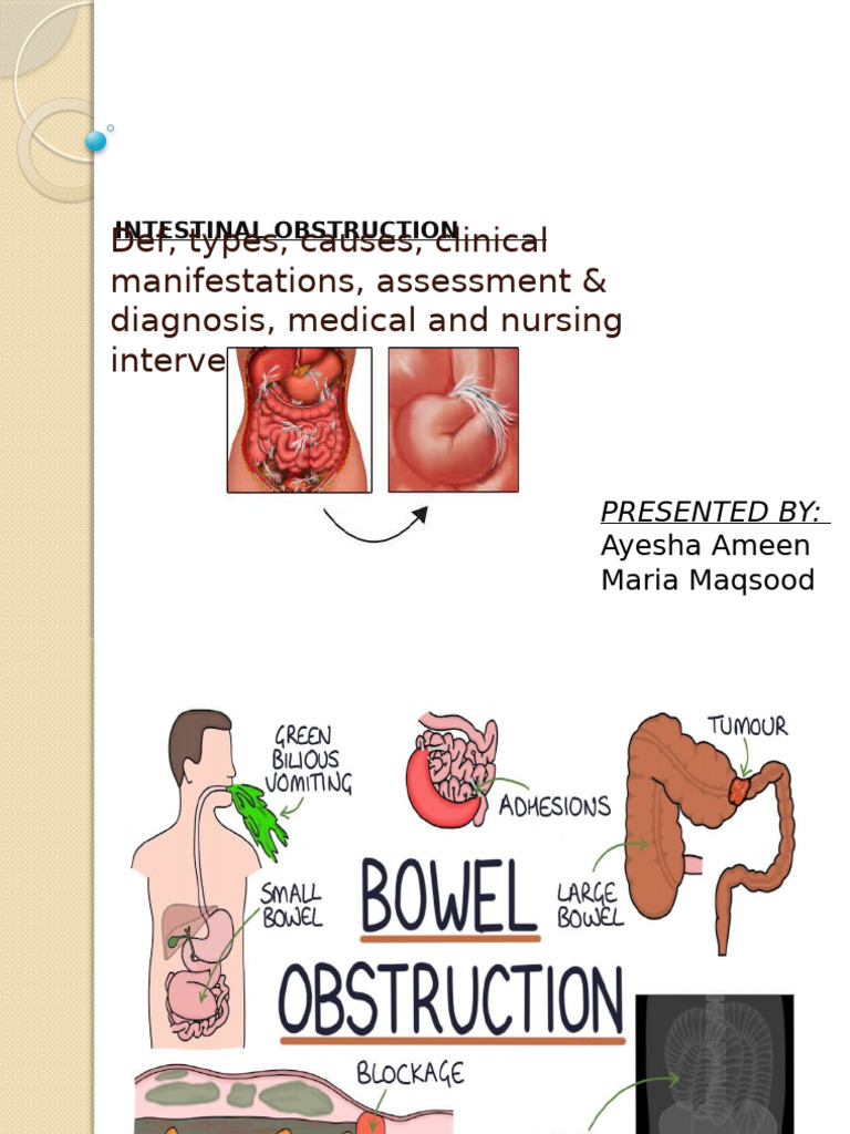 Intestinal Obstruction | PDF