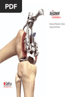 DSUSJRC07150917 Rev 3 Attune Cementless Surgical Technique | PDF | Knee ...