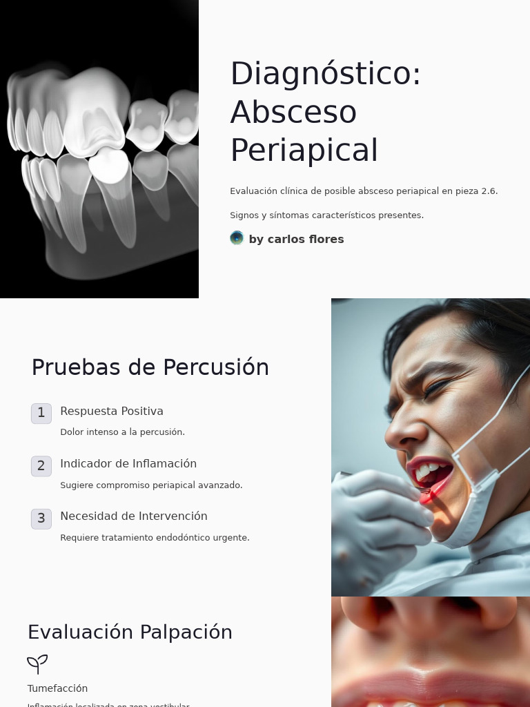 Diagnostico Absceso Periapical | PDF